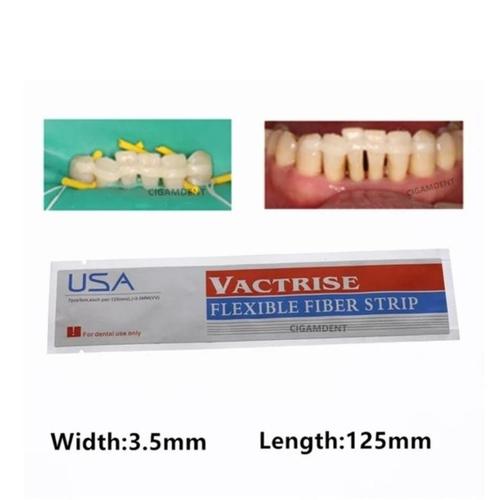 Jual Dental Fiber Splinting Splint Strip Endo - Kota Depok - Nuu Stoore ...