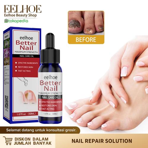 Jual EELHOE Better Nail Maximum Strength Anti Infection Nail Solution ...