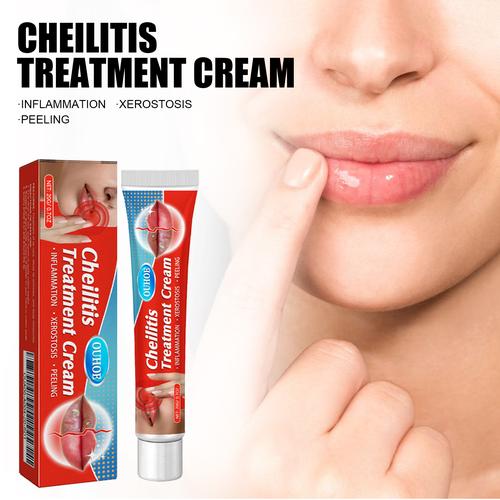 Promo Cheilitis Cream Bibir 20g Cheilitis Treatment Cream Pelembap ...