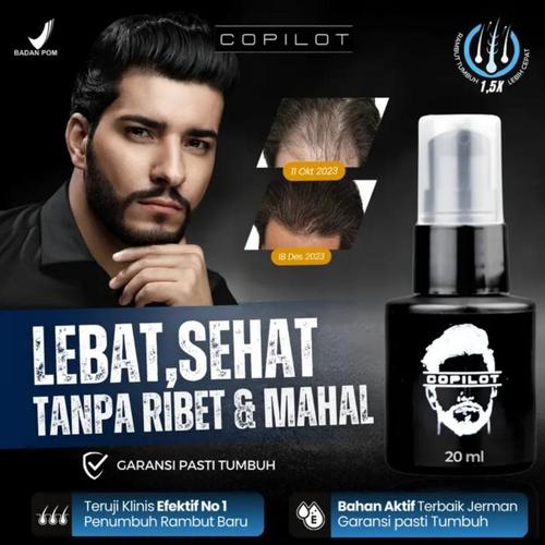 Jual COPILOT SERUM OBAT PENUMBUH RAMBUT BOTAK CEPAT TEBAL PENUMBUH ...
