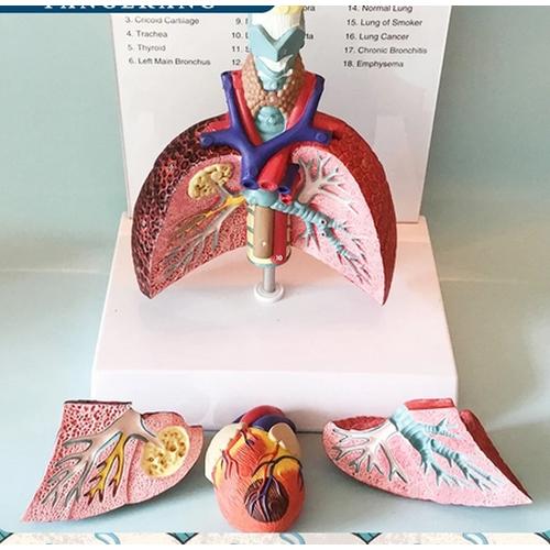 Jual Model Anatomi Sistem Pernapasan / Alat Peraga Paru-Paru Manusia ...