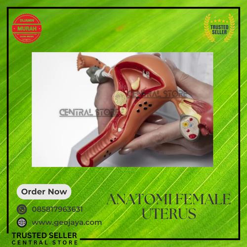 Jual Alat Peraga / Manekin Model Uterus Sakit ,Anatomi Female Uterus Ovary Disease, - Kab. Bogor ...