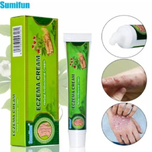Jual SUMIFUN ECZEMA CREAM RIM ANTI GATAL SALEP KULIT EKSIM DERMATITIS ...