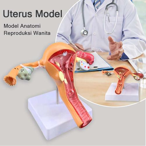 Jual Uterus Ovary Anatomical Model Anatomy Alat Peraga Anatomi Model ...
