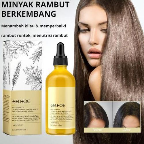 Jual Ekstrak Tumbuhan Minyak Esensial Pertumbuhan Rambut Rosemary ...