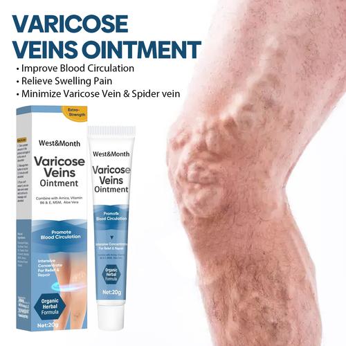 Promo West&Month Varicose Veins Ointment 20g Obat Varises Kaki Dan ...