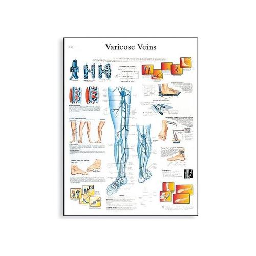 Jual 3B Scientific Vr3367L Kertas Laminasi Tahan Uv Mengkilap Afeccion ...