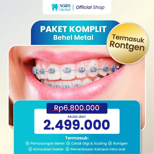 Promo Paket Behel Metal Basic Komplit: Pemasangan Rahang Atas dan Bawah ...