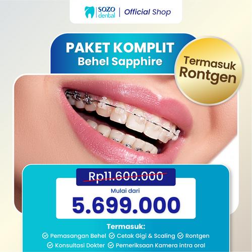 Jual Paket Behel SAPPHIRE BENING ESTETIK Komplit: Pemasangan Rahang ...