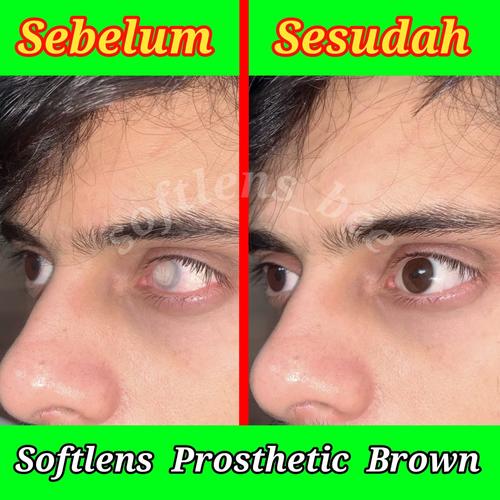 Jual [SOFTLENS MURAH] ORIGINAL SOFTLENS MATA CACAT / PROSTHETIC LENS ...