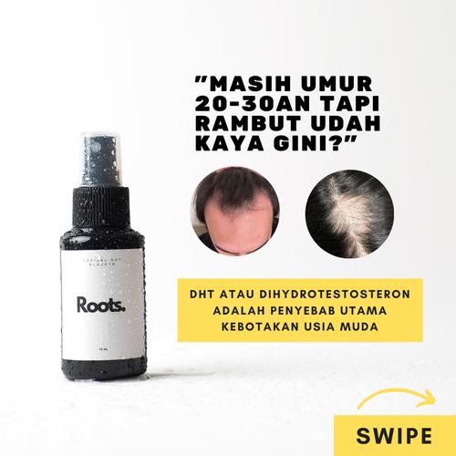 Jual Serum DHT Bloker Rambut Rontok ROOTS - Kota Depok - Carague ...