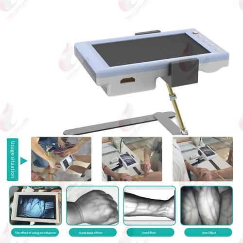 Jual Vein Finder Vein Viewer/Alat Pendeteksi Pembuluh Darah Portabel ...