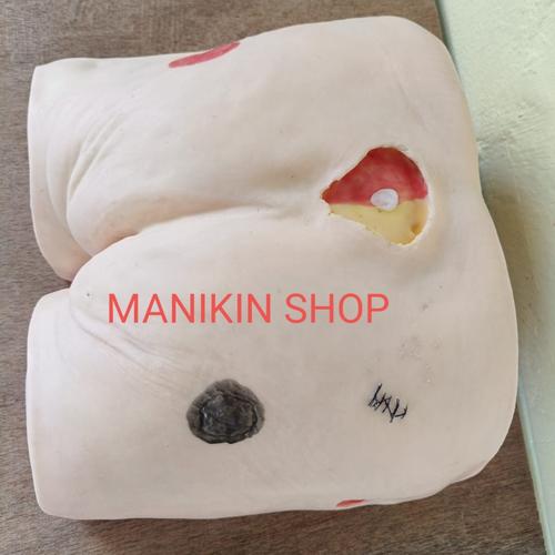 Jual Ulkus Dekubitus | Phantom Manikin Dekubitus | Model Luka Decubitus ...