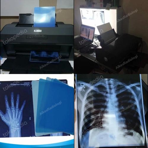 Jual Medical Dry Film Radiology Inkjet (Blue Inkjet Film) Ukuran A4 ...