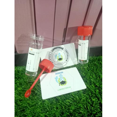 Jual Pot Feces, Pot Feses, Stool Container, Pot Feces, feaces tube ...