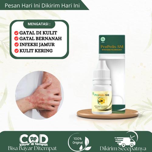 Promo Propolis SM untuk Gatal di kulit, Gatal bernanah, Jamur di kulit ...