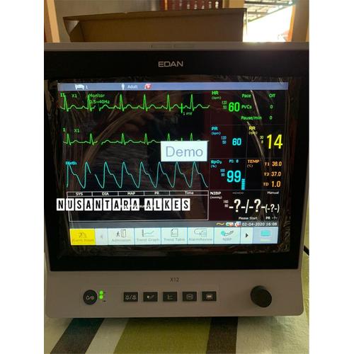 Jual PATIENT MONITOR / PASIEN MONITOR EDAN X12MURAH 12 INCHI - Kab ...
