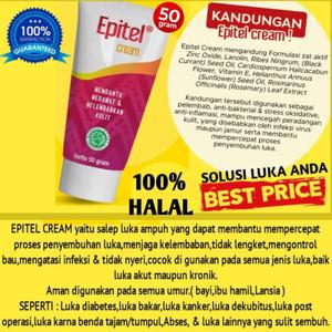 Jual EPITEL CREAM SALEP LUKA 50gr Limited - Jakarta Barat - Taamirin ...