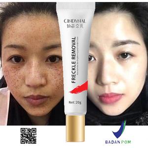 Jual [BPOM] CINDYNAL Krim Penghilang Flek Bintik hitam Jerawat Whitening - Jakarta Barat - vonzy ...