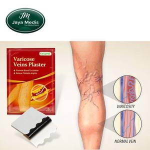 Jual Plester Varises - Varicose Veins Plaster 6pcs - Kota Surabaya ...