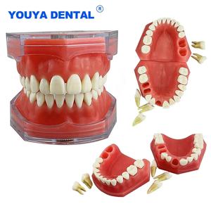 Jual Dental Model Removable Teeth Model Detachable Implant Soft Gum ...