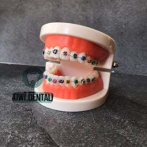 Jual Dental model study model studi gigi brace rahang gigi - Brace ...