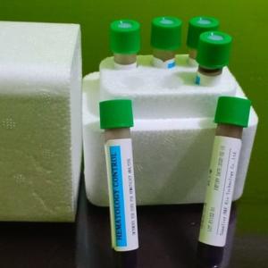 Jual blood kontrol hematology 3D Normal - Jakarta Barat - Endang Berkah ...