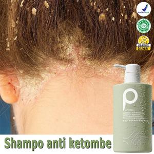 Jual Hot!! Shampoo Anti Ketombe Sampo Ketombe Garam Laut Shampoo 500Ml - Jakarta Timur ...
