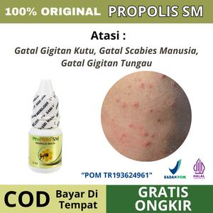 Jual Obat Gatal Gigitan Kutu, Scabies Manusia, Gigitan Tungau, Propolis ...