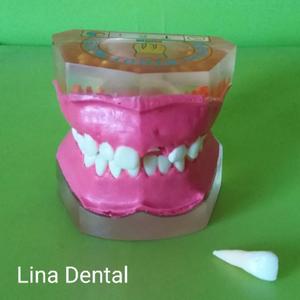 Jual Dental Study Model Lepasan Transparant Pantom Gigi Model Lepasan ...