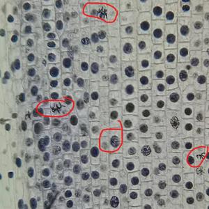 Jual Disiapkan Slide Ujung Akar Bawang 5 Buah Mitosis Slide Set Mitosis ...