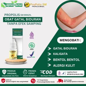 Jual Obat Biduran, Obat Ruam Merah, Obat Kaligata, Obat Gatal Kulit ...