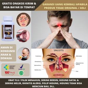 Jual Obat Flu Pilek Menahun Obat Sering Bersin Obat Rhinitis Hidung ...