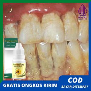 Jual Obat Herbal Karang Gigi Ulat Gigi Anti Karang Gigi Membandel ...
