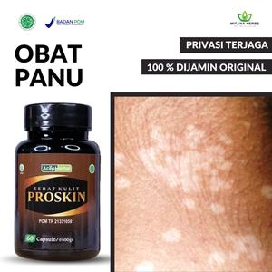 Jual Mitana Herbal - Obat Panu Obat Panu Tablet Obat Panu Anak Obat ...