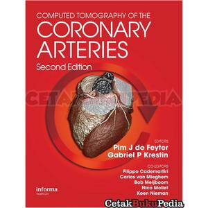 Jual Computed Tomography of Co ronary Arteries - Kota Yogyakarta ...