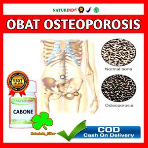 Jual Obat Osteoporosis Penguat Tulang Patah Nutrisi Tulang Keropos ...