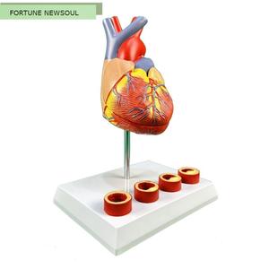 Jual Model Anatomi Jantung Manusia Model Anatomi Medis Untuk Edukasi ...