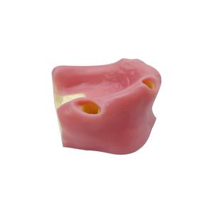Jual Best Dental Implant Practice Model No Tooth Maxillary Sinus With ...