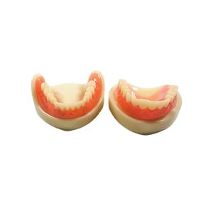 Jual Dental Full Denture Model Magnetic Attachment Mandibular Upper ...