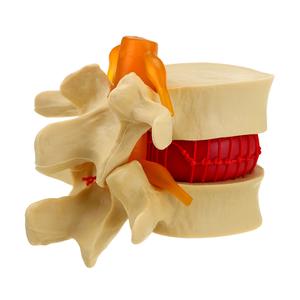 Jual HP Medical Lumbar Vertebrae Model Props Anatomical Spine ...