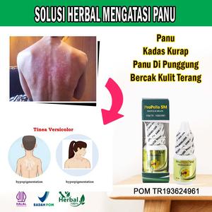Promo Obat Panu, Panu Di Punggung, Kadas Kurap, Untuk Anak Dan Dewasa ...