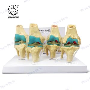 Jual Knee Joint Model Set | Human Body Anatomy Replica Set of 4-Stage ...