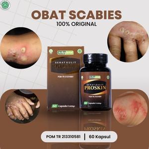 Jual Proskin - Obat Scabies manusia , Obat gudig / Gudikan, Obat Luka ...