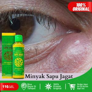 Jual Obat Mata Bintitan, Bintitan di Bawah Mata, Kalazion, Timbilen ...