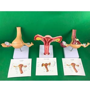 Jual Ovary and uterus disease Dissection model Pathology Female uterus ...