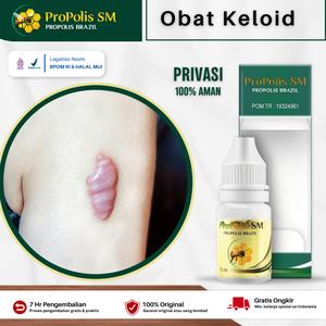 Jual Propolis Sm Obat Keloid Daging Tumbuh Keloid Bekas Operasi Kloid Injeksi Keloid Menahun ...