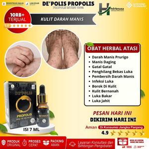 Jual Obat Darah Manis Prurigo Manis Daging Borok Di Kulit Koreng Di ...
