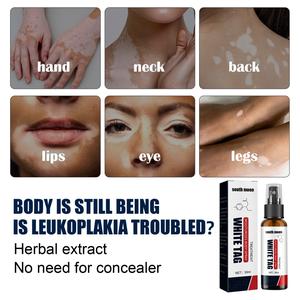 Jual IMPORT Vitiligo Spray Treatment Vitiligo Spray External Skin ...