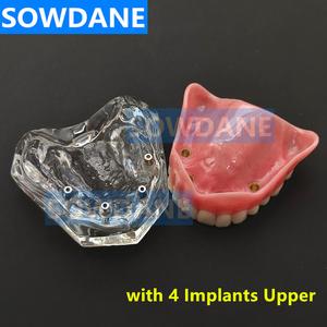 Jual IMPORT Dental Implant Demonstration Model Teeth Study Teach Model ...